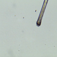 Schistosomiasis