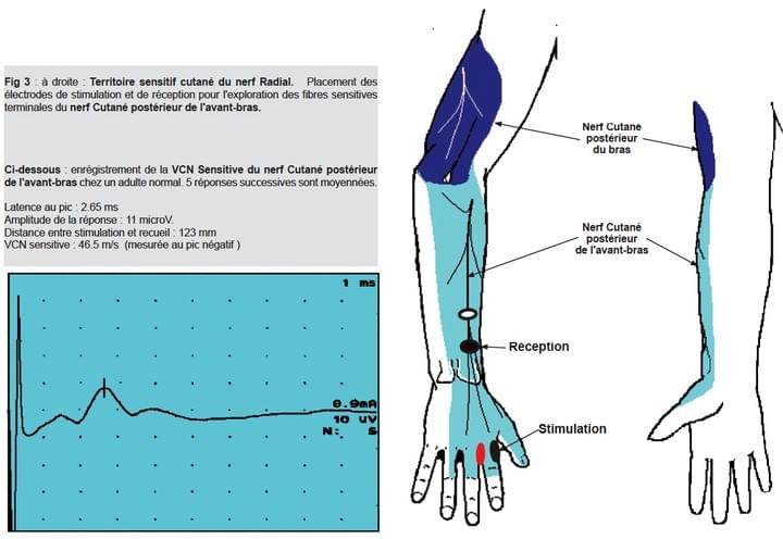 Neurophysiologie - Volume 2