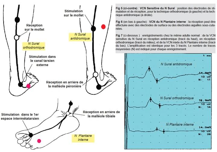 Neurophysiologie - Volume 2
