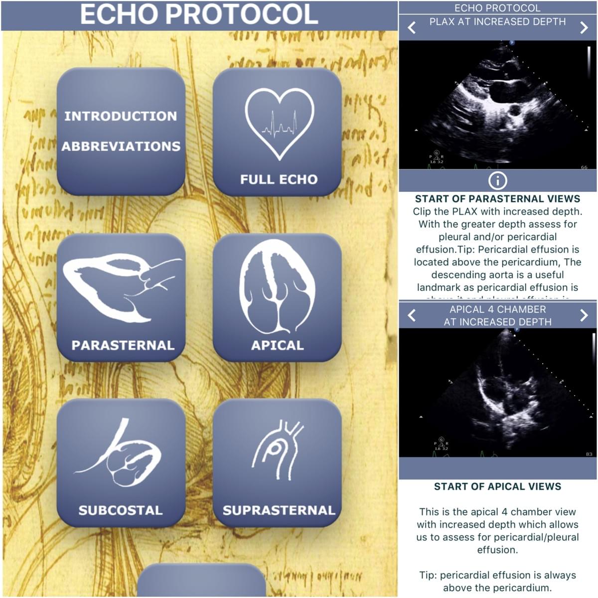 Echocardiography By Me
