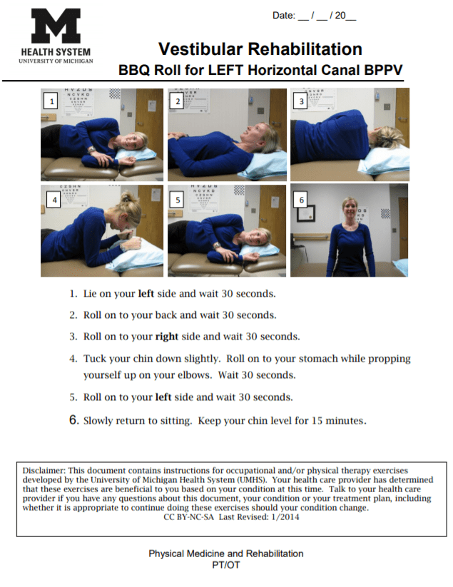Bppv Exercises Patient Handout Sudden Dizziness? It Could Be Benign
