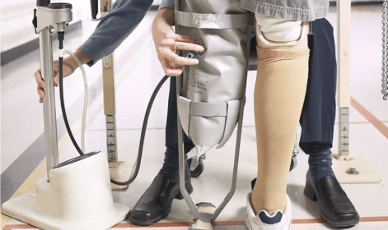 The Benefits Of Orthotics And Prosthetics