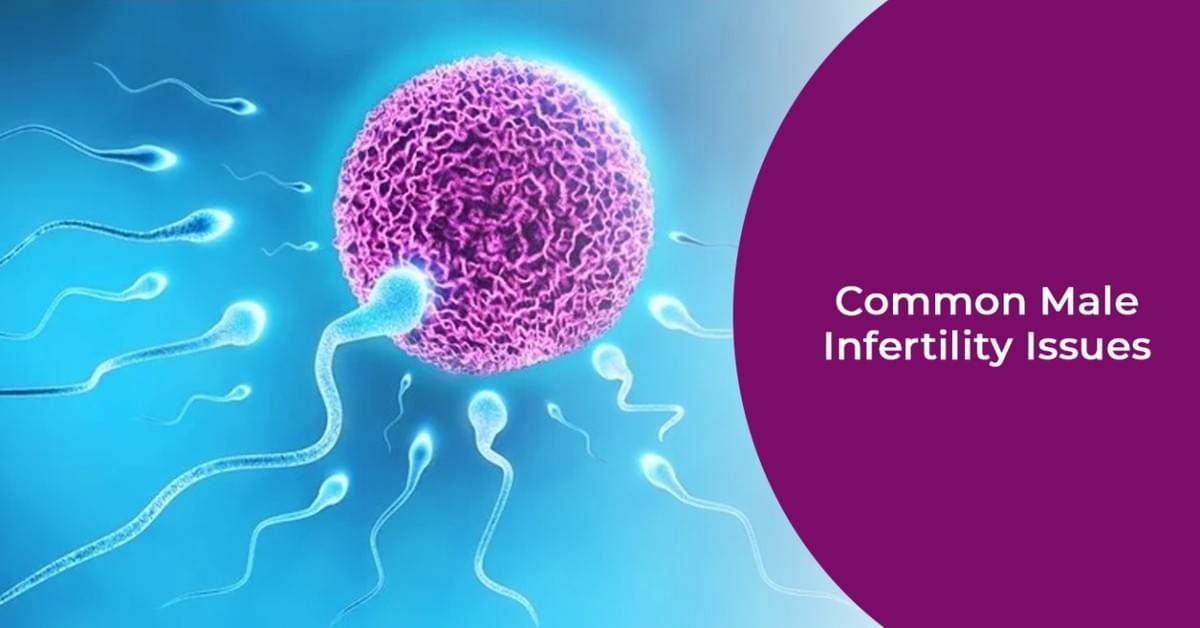 Common Male Infertility Issues At a Glance
