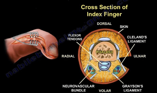 Compartment Syndrome of the Hand and Finger - hand Orthopedic Surgery ...