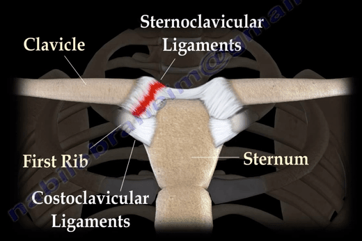 Sternocalvicular Joint Dislocations - collarbone dislocations ...