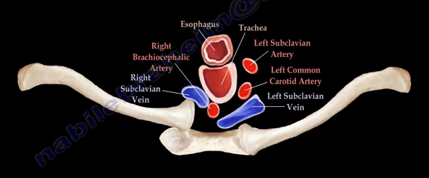 Sternocalvicular Joint Dislocations - collarbone dislocations ...