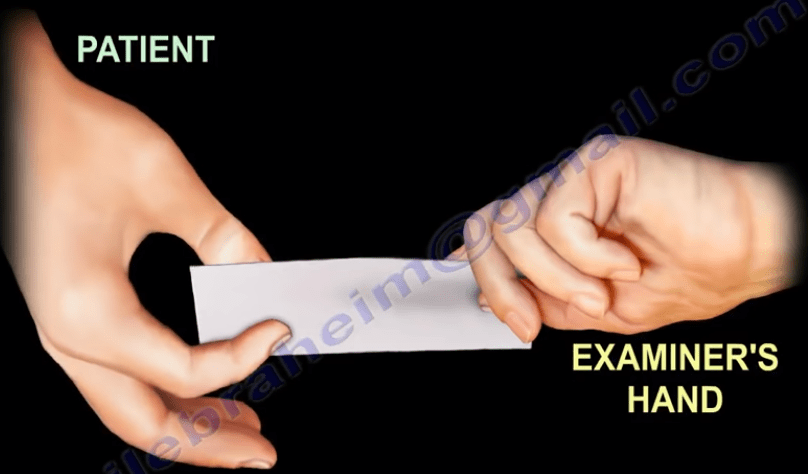 Froment’s Sign - Orthopedics Hand Nerve Injury Nabil Ebraheim Healthcare