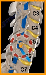 Double Crush Syndrome - Healthcare Double Crush nerve injury Orthopedic ...