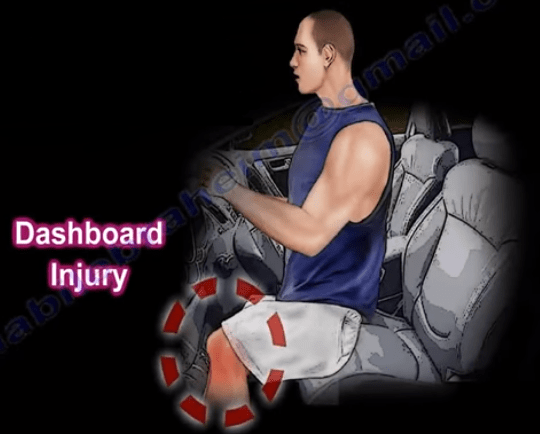 A History and Examination of the Painful and Injured Knee ...