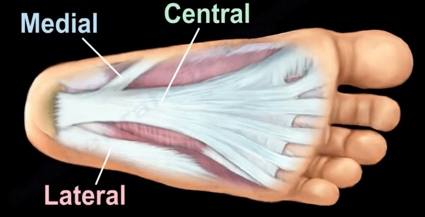 Rupture of the Plantar Fascia - Orthopedic Surgery Foot...