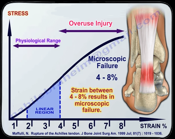 Achilles Tendon Stress and Strain - Healthcare Orthopaedics Achilles ...